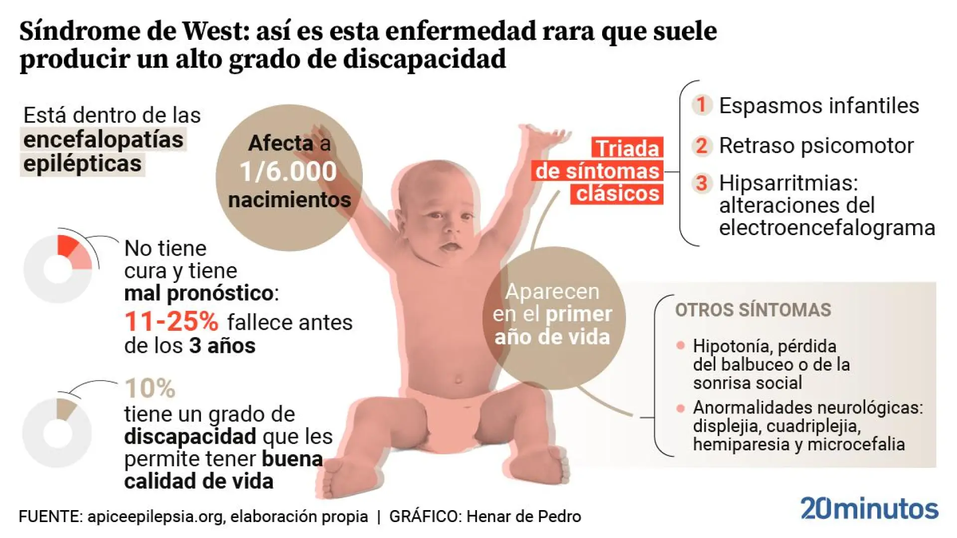 Síndrome de West, un raro trastorno neurológico que puede provocar ...