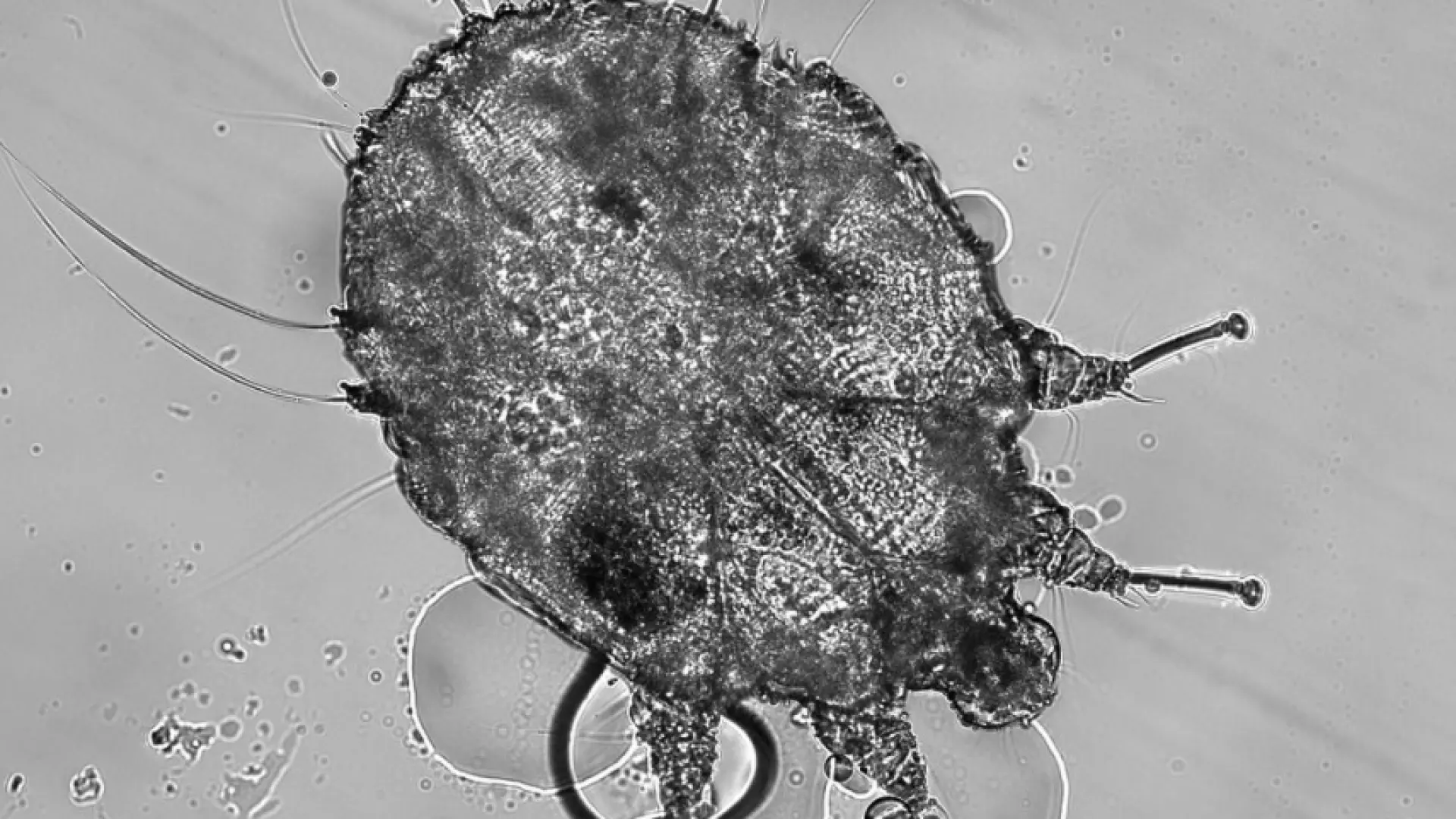 Salud Pública alerta del aumento de casos de sarna en Donosti y activan una campaña de ...