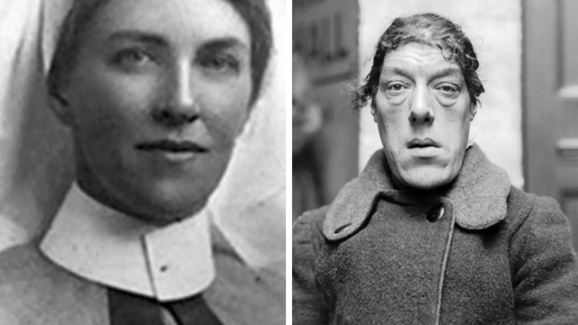 La historia de la mujer que se convirtió en la "más fea del mundo" para ...