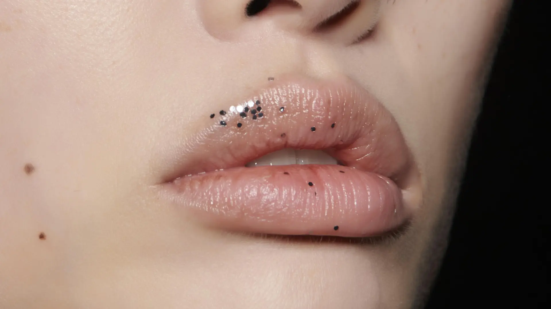 Por qué salen una calentura o herpes labial: causas, cuánto dura y ...