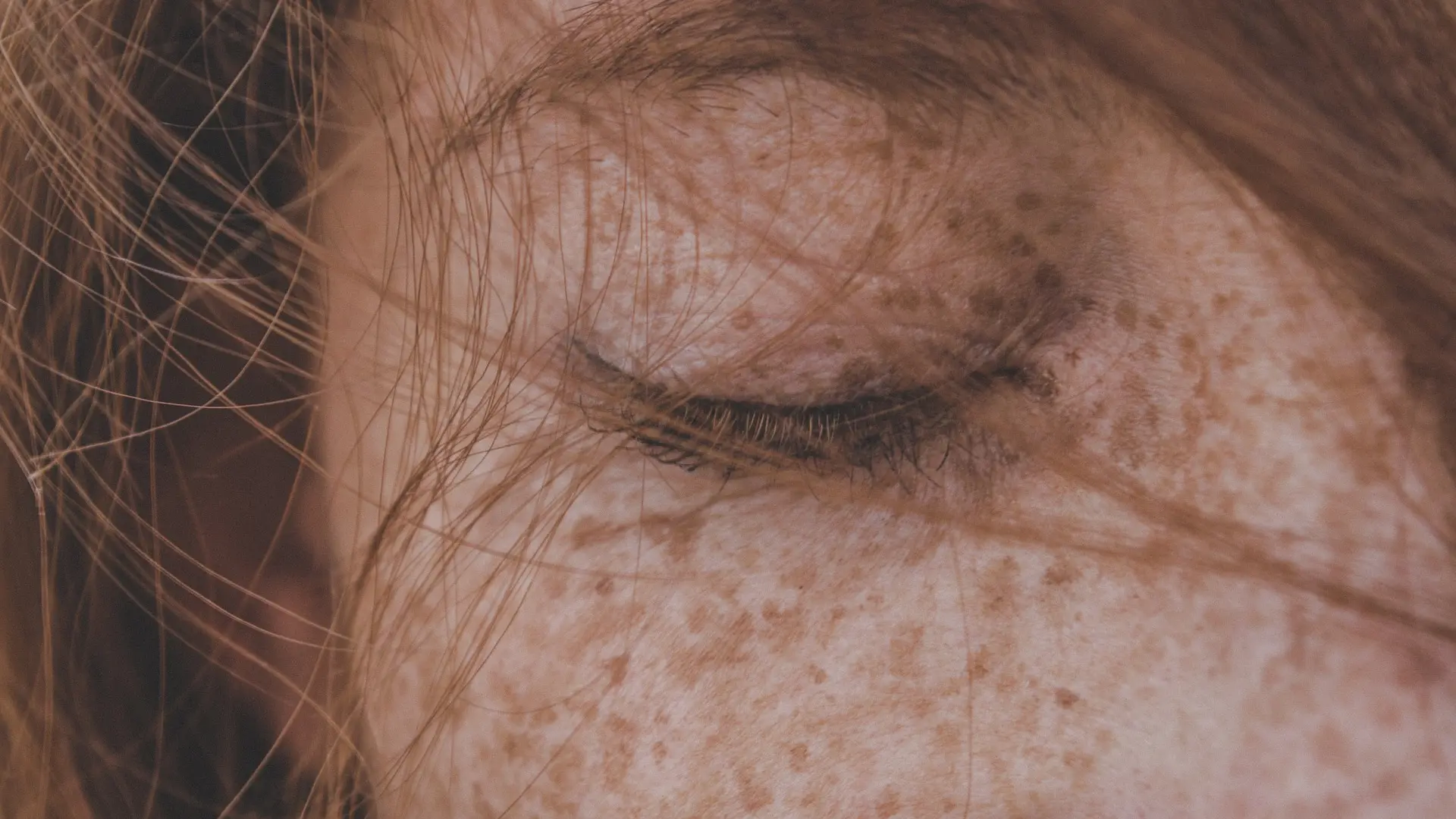 Las pecas: qué son, por qué salen y cómo cuidarlas