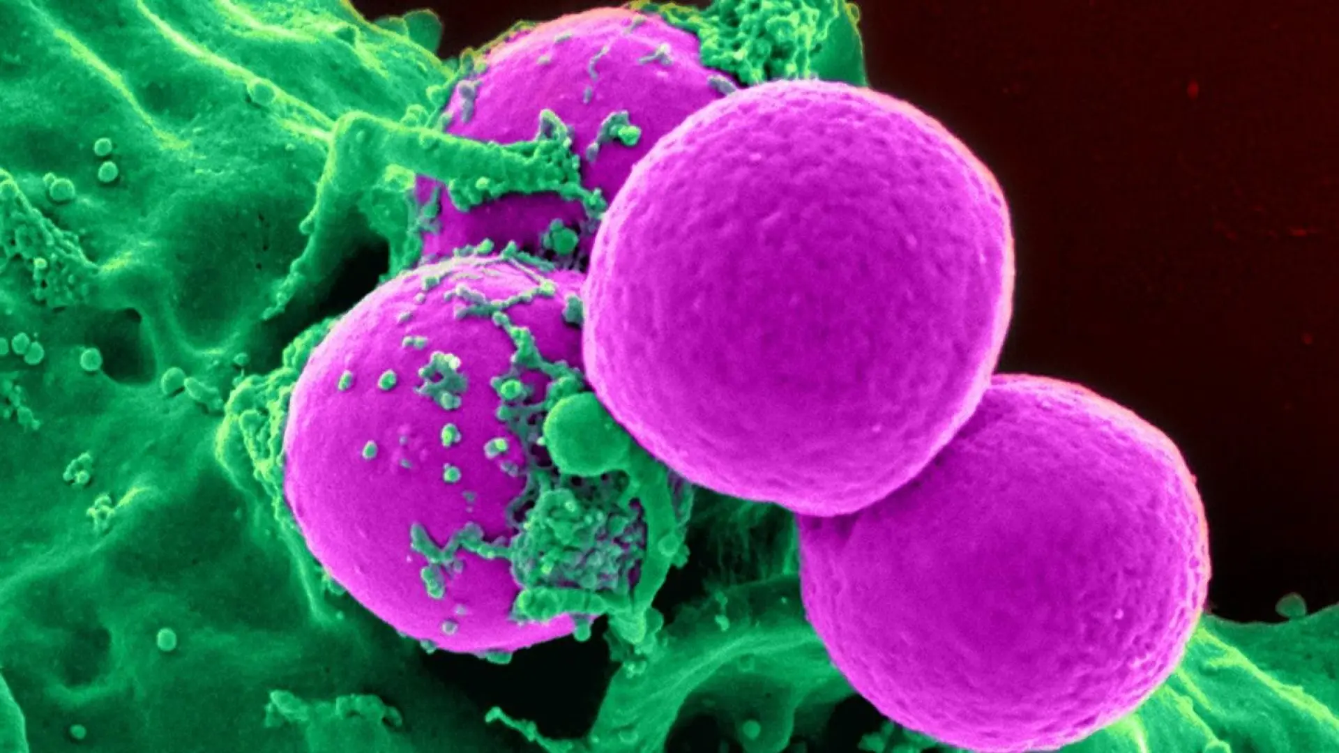 ¿Cuáles son los niveles normales de glóbulos blancos en sangre en los niños?