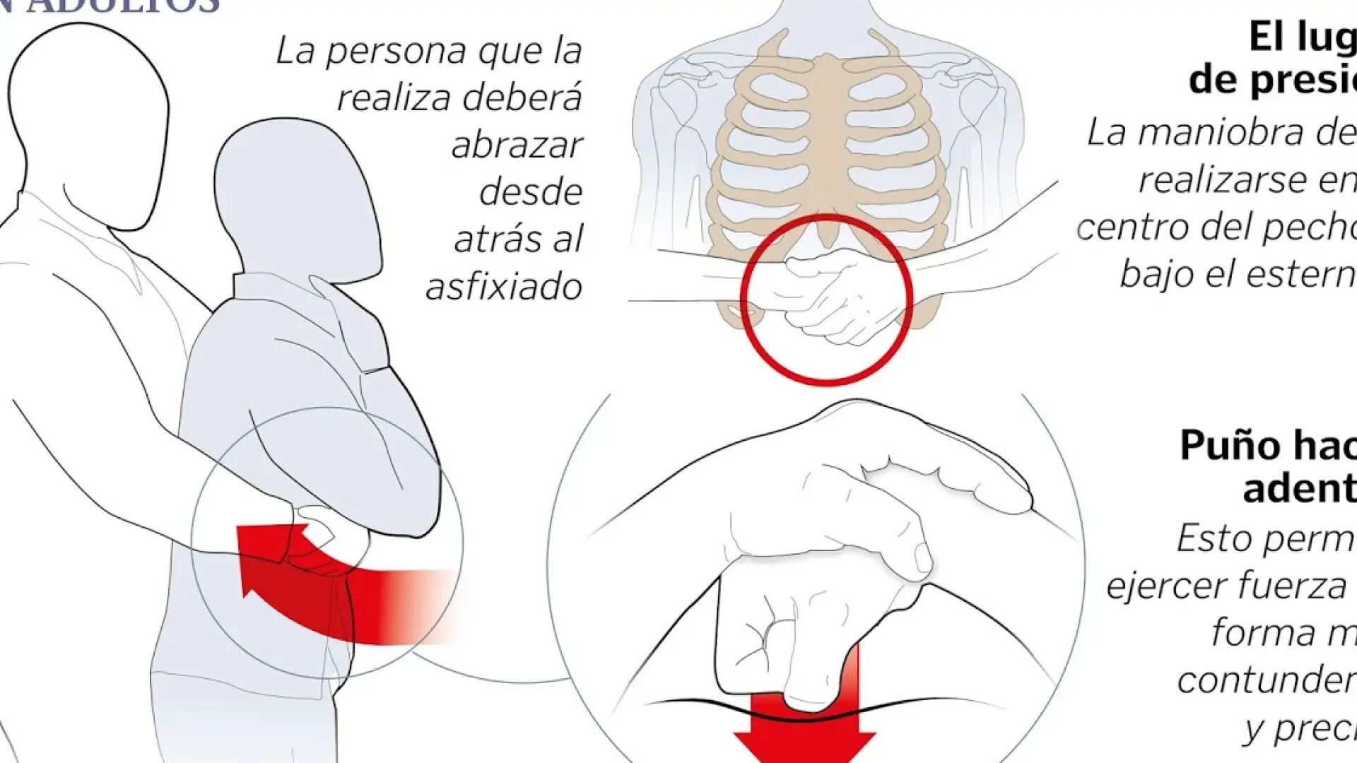 Cómo se hace la maniobra de Heimlich: los pasos que pueden salvar la ...