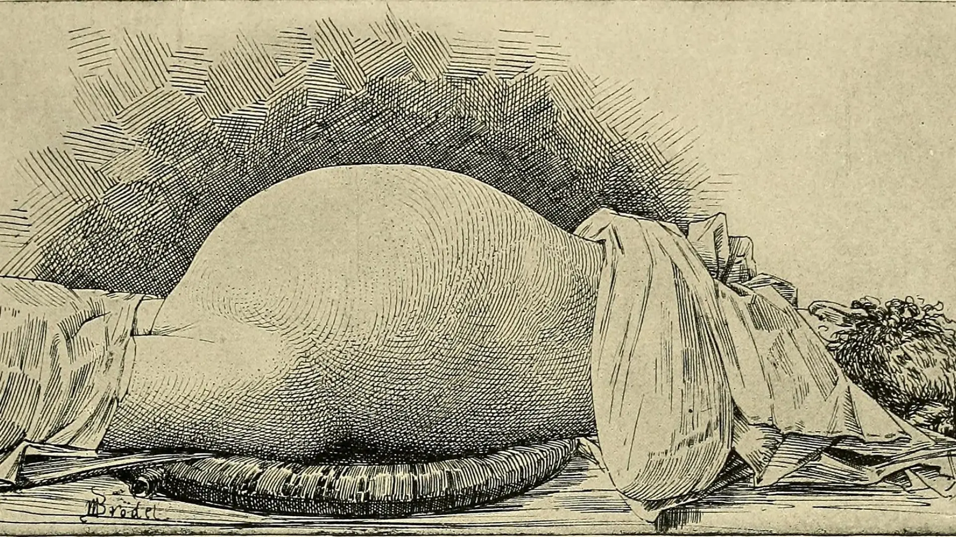 Cómo reconocer la ascitis, un síntoma de muchas enfermedades graves