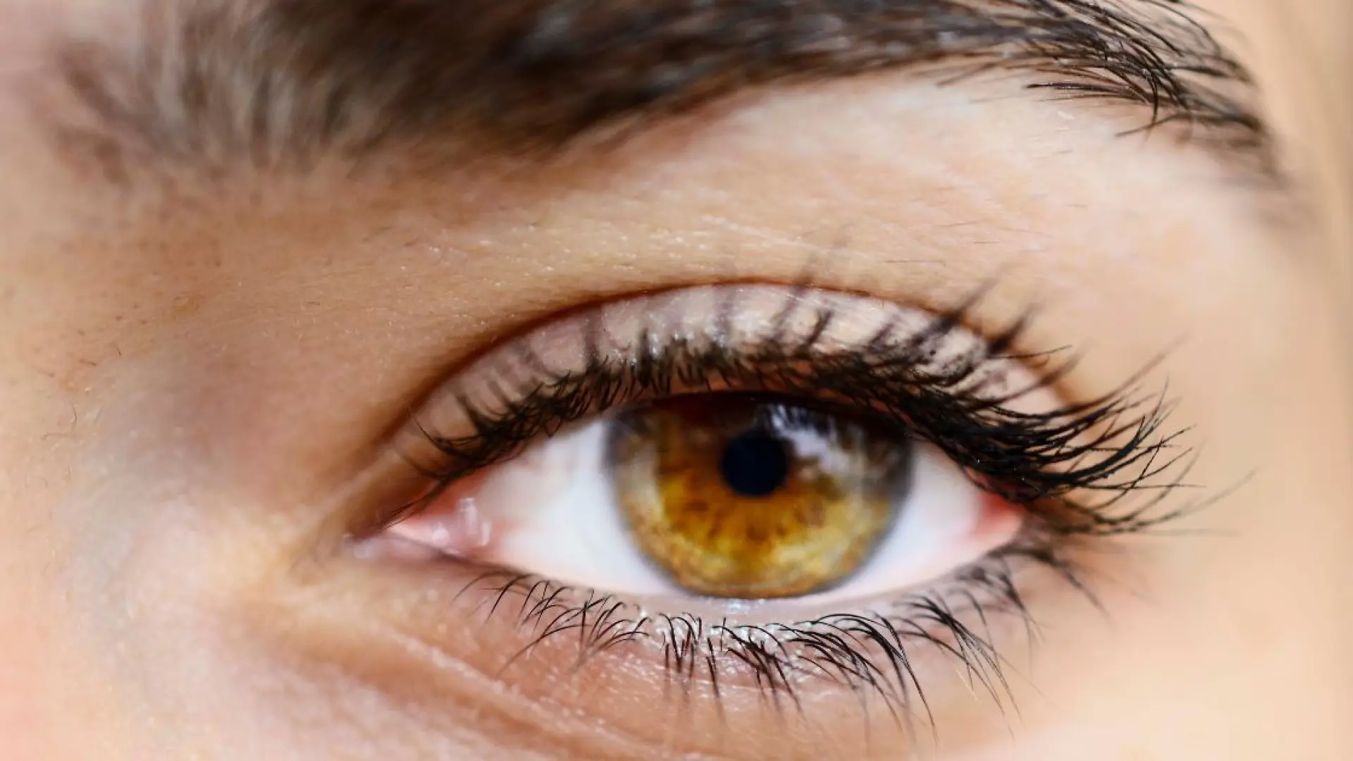 Síntomas y causas del estrabismo