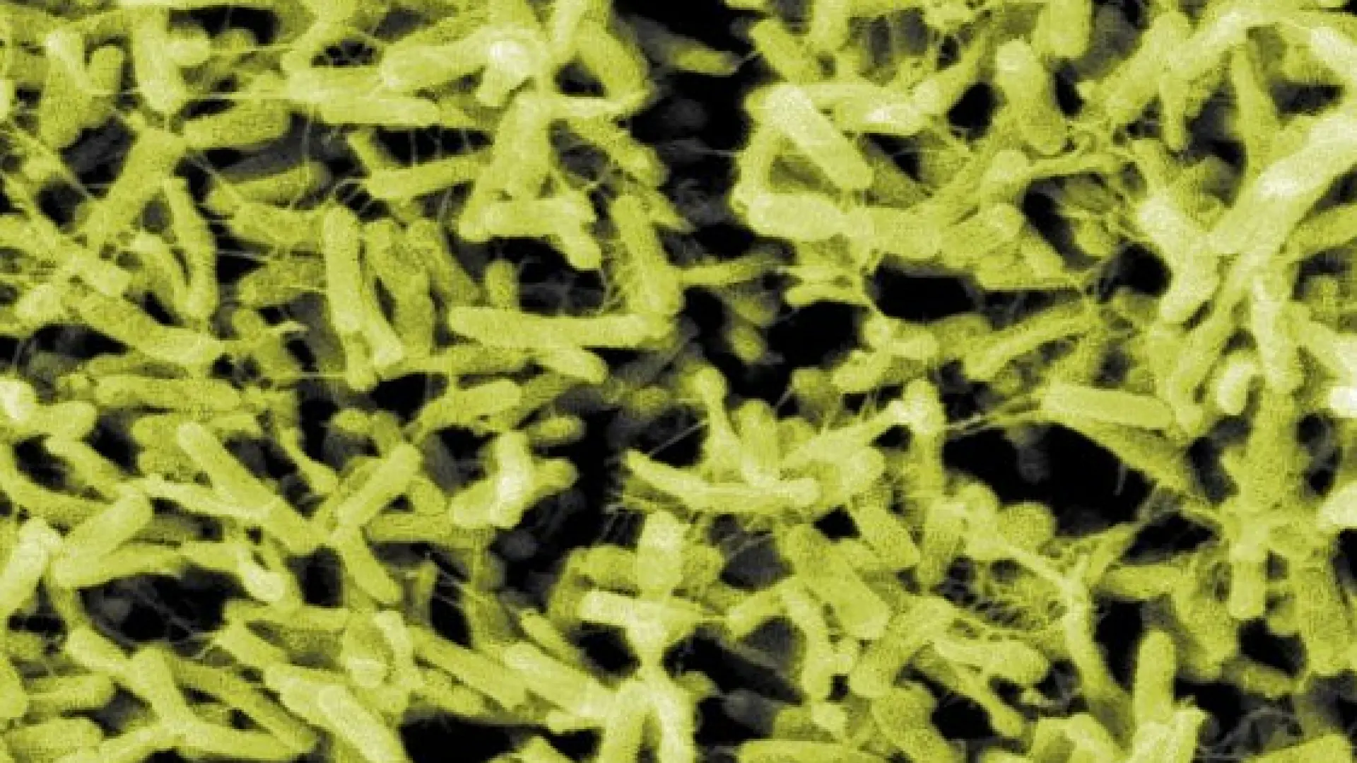 Fotos: Estas son las 'superbacterias' más letales | Imágenes