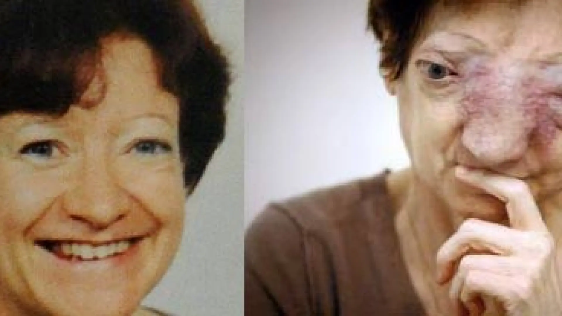 Francia se replantea legalizar la eutanasia tras la muerte de Chantal ...