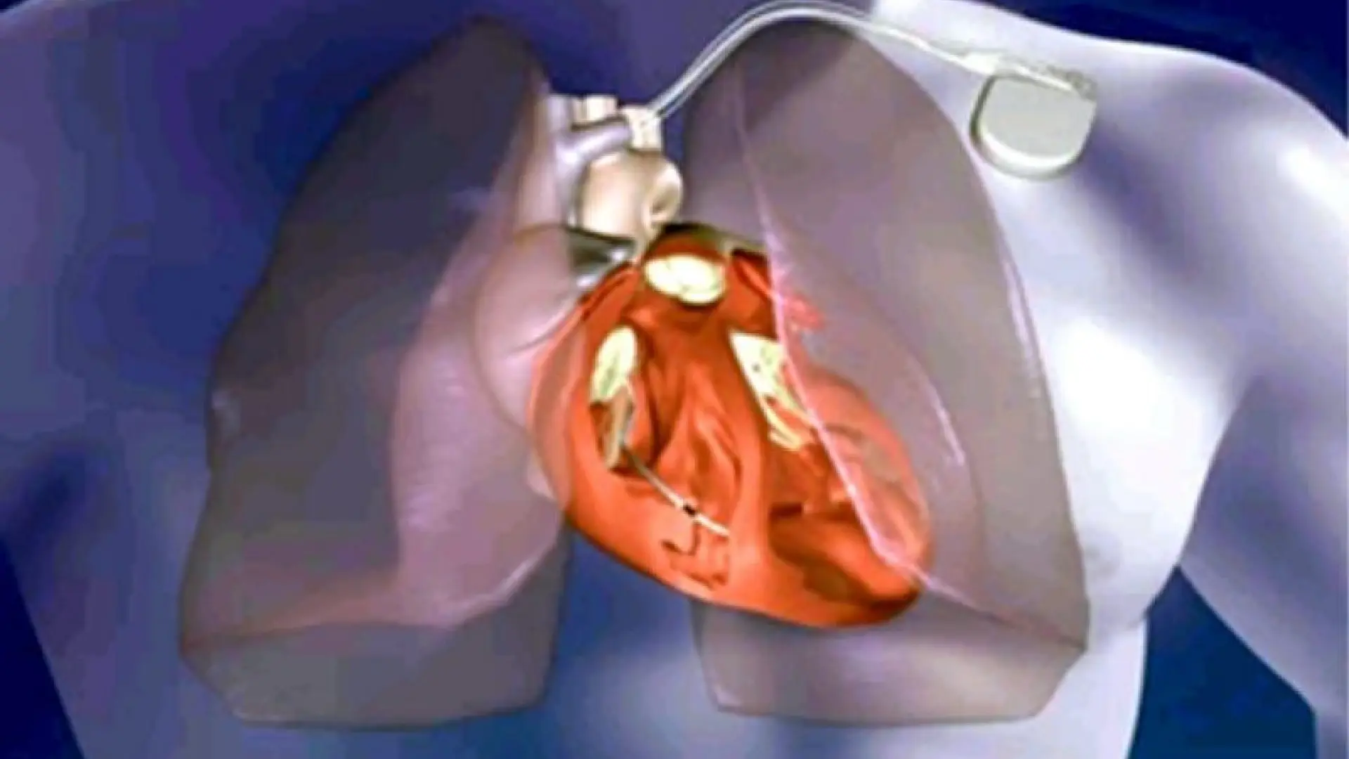 ¿Por qué no hay casos de cáncer de corazón?