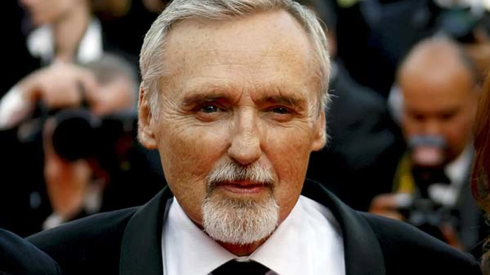 El actor Dennis Hopper lucha contra un cáncer de próstata