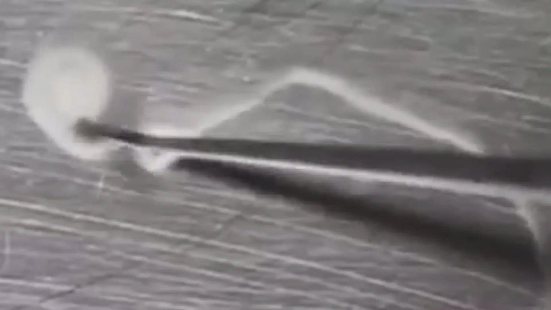 Qué es la tenia, cuáles son sus síntomas y cómo evitar contraer la ...