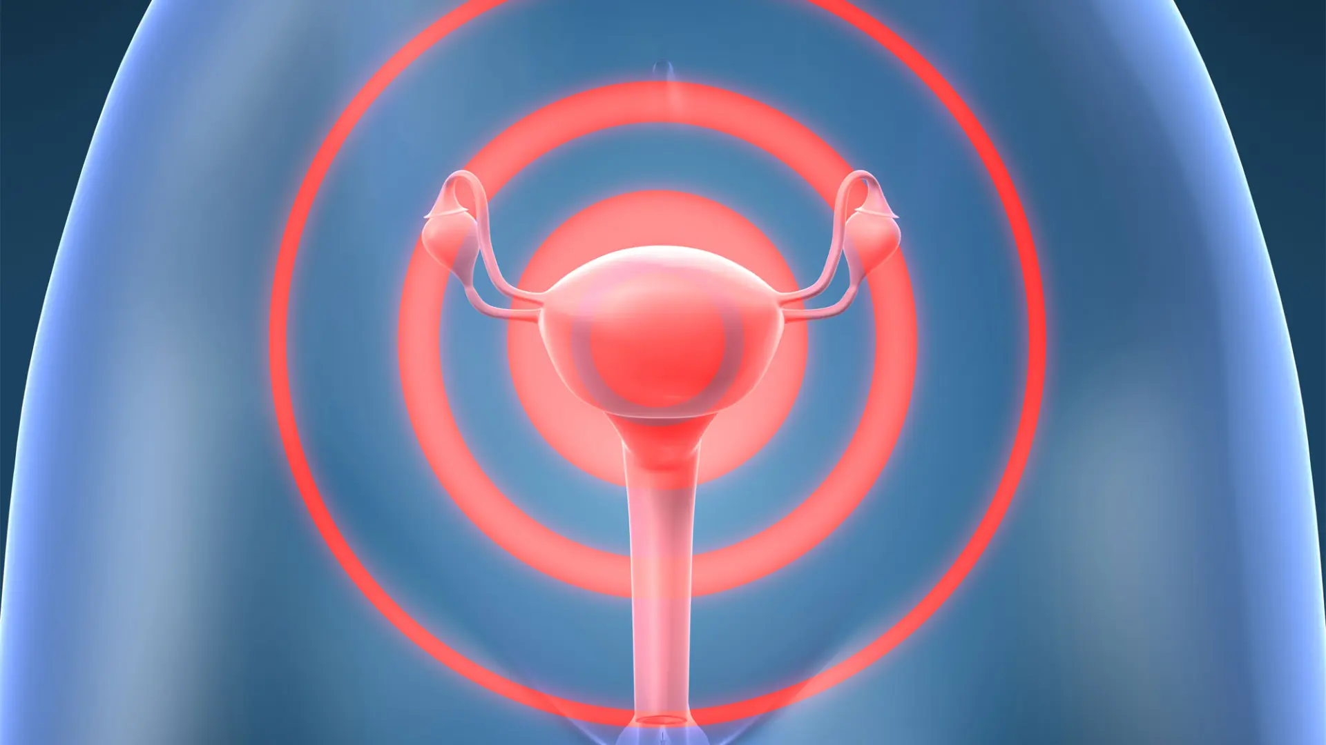 Qué es el útero septo o tabicado, la malformación uterina más frecuente