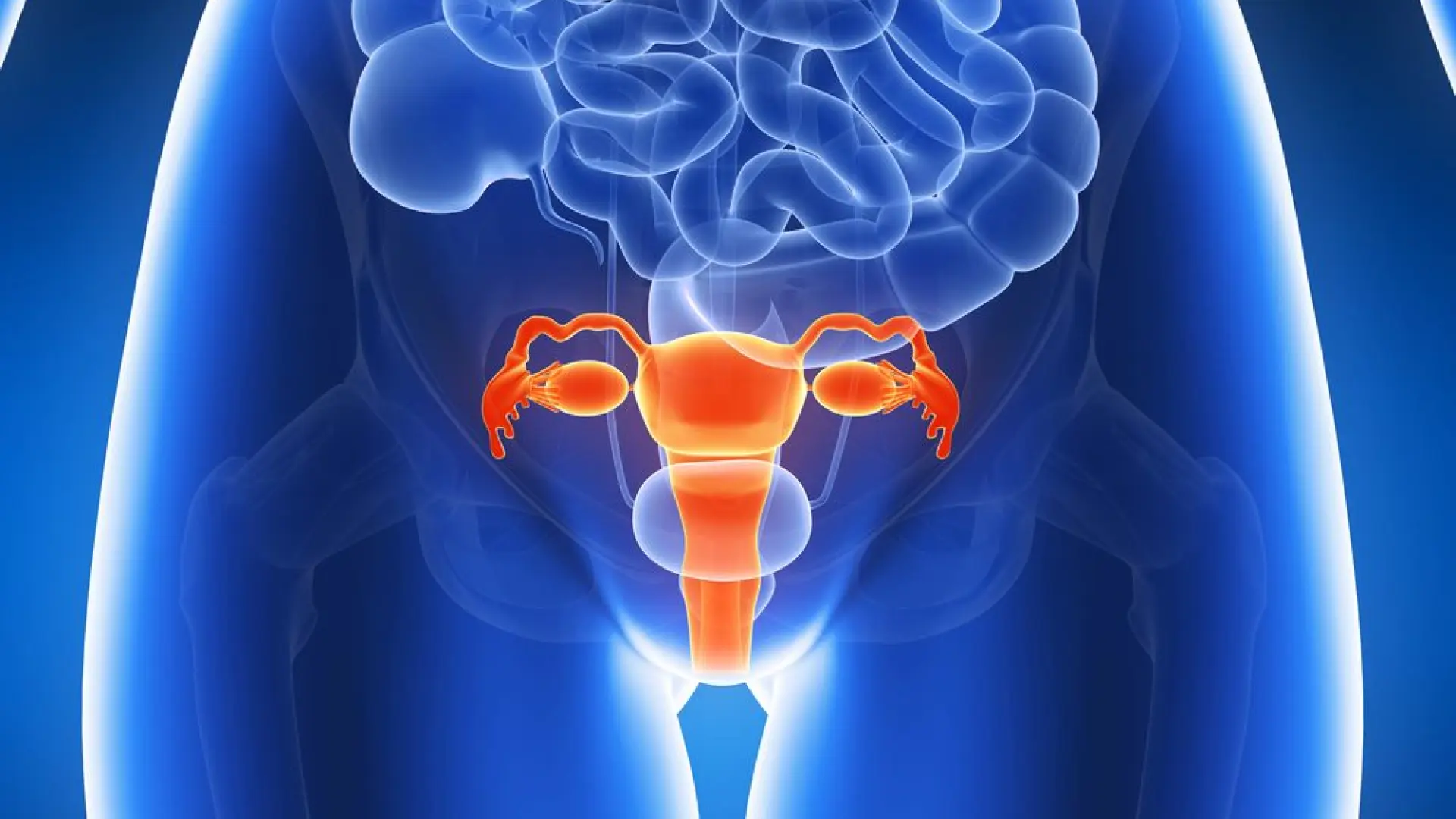 Endometriosis: qué es, diagnóstico y tratamiento