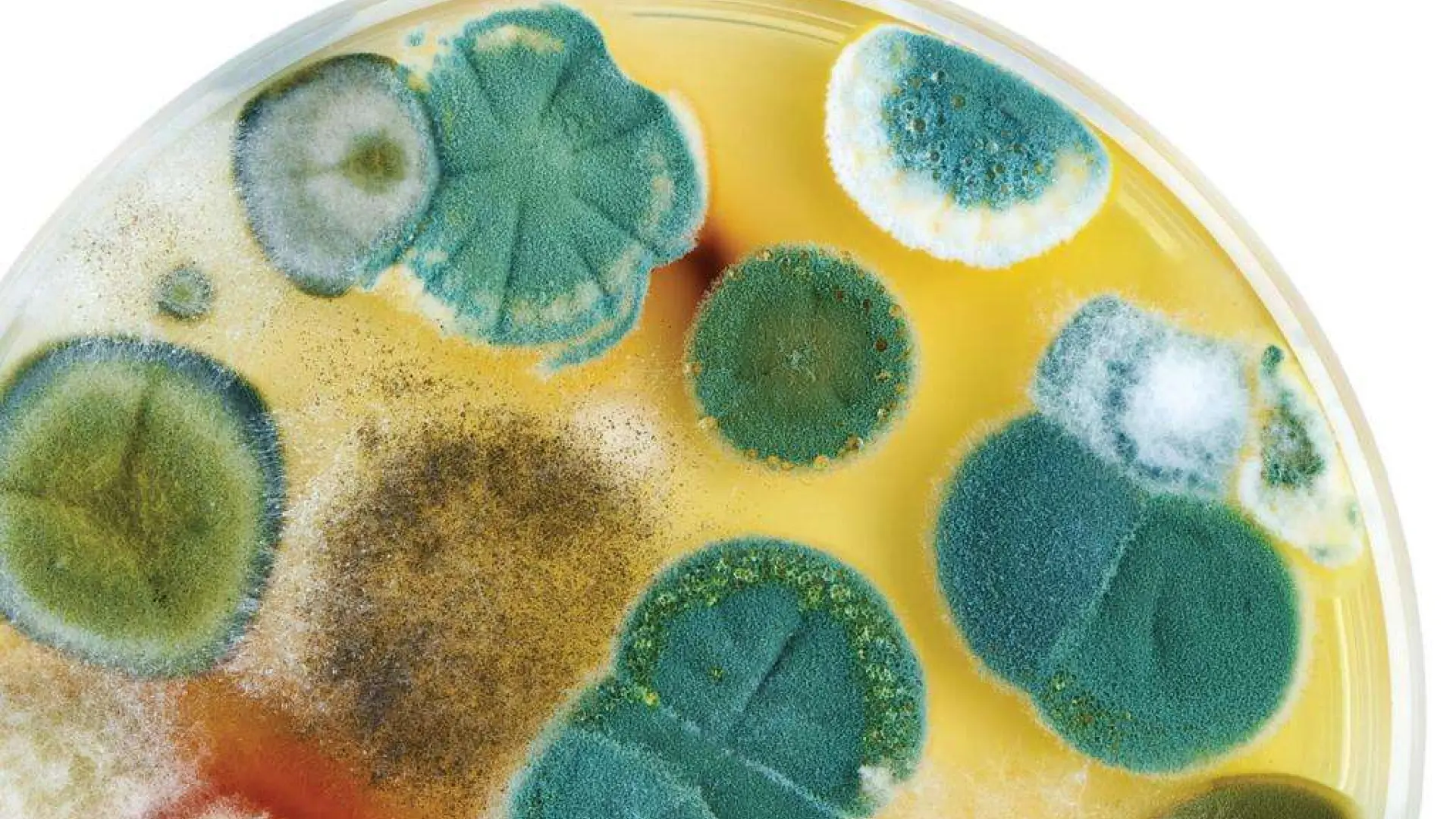 ¿Por qué salen hongos en la ropa de mi armario (y no solo ahí)?