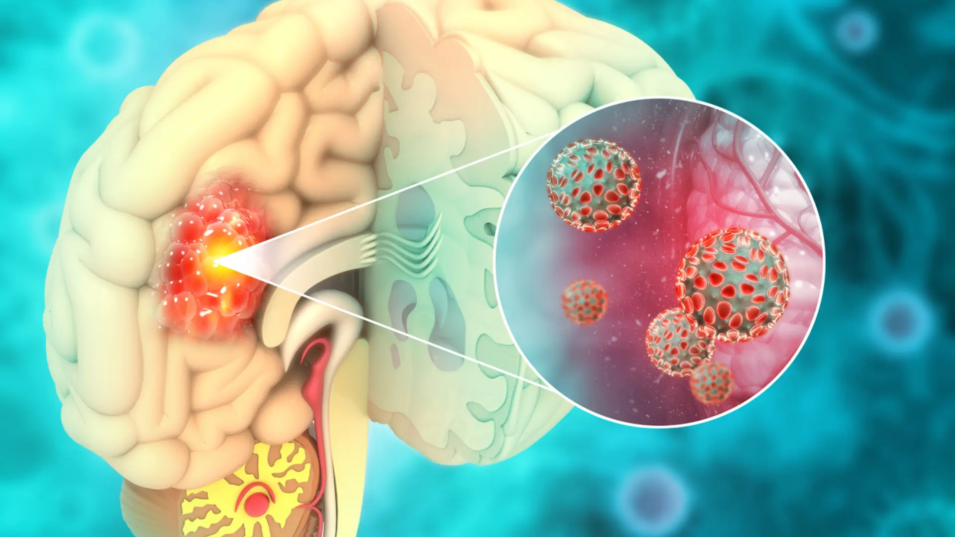 Investigadores consiguen por primera vez que la quimioterapia penetre ...