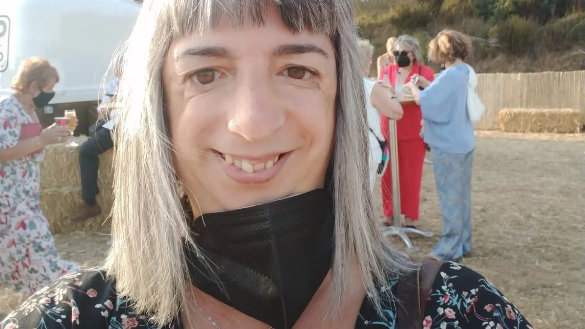 Eva Puga, con síndrome Treacher Collins: "Queremos que nos conozcan ...