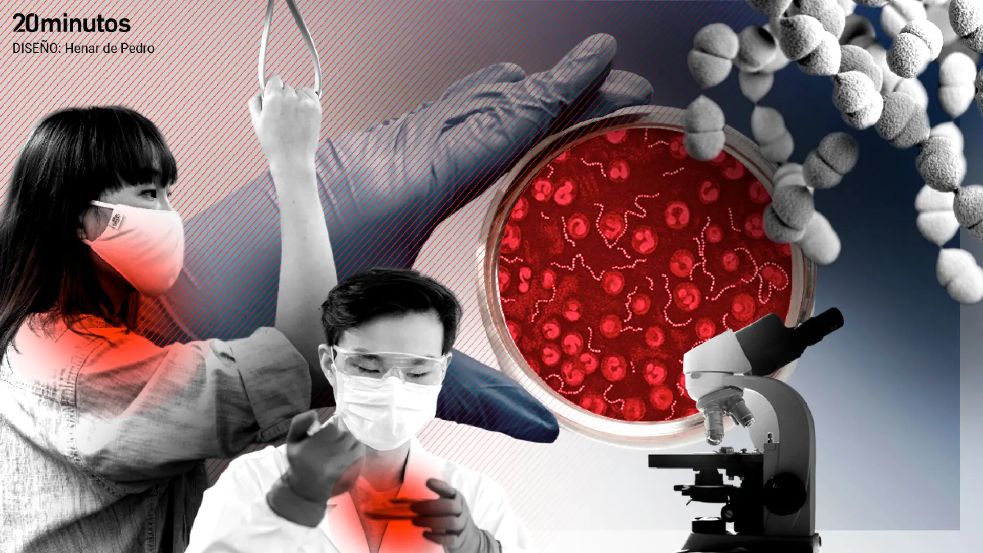 Así es el STSS, la "enfermedad carnívora" detectada en Japón que tiene un potencial mortal y se ...