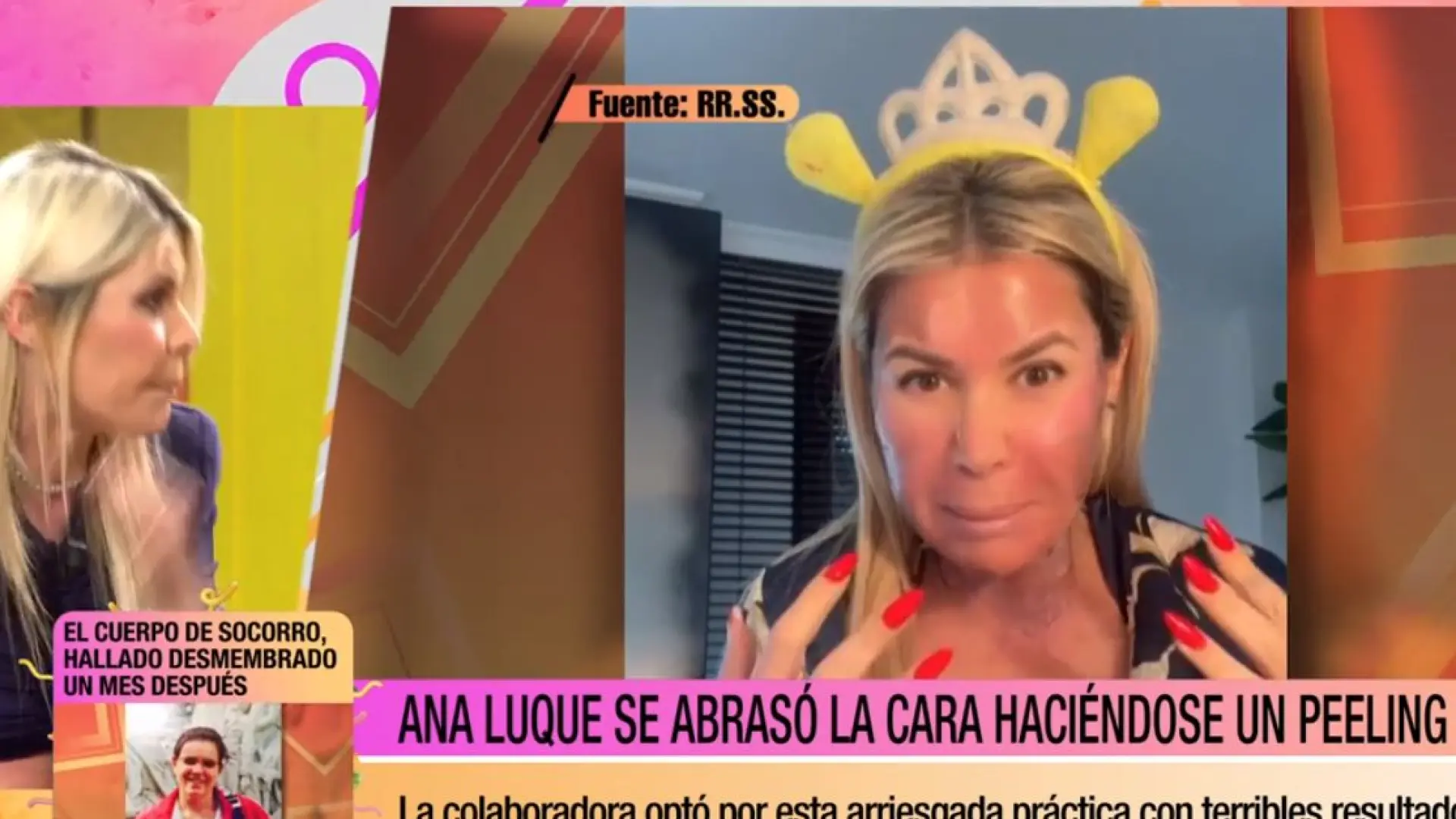 Ana Luque se quema la piel de la cara tras someterse a una limpieza ...