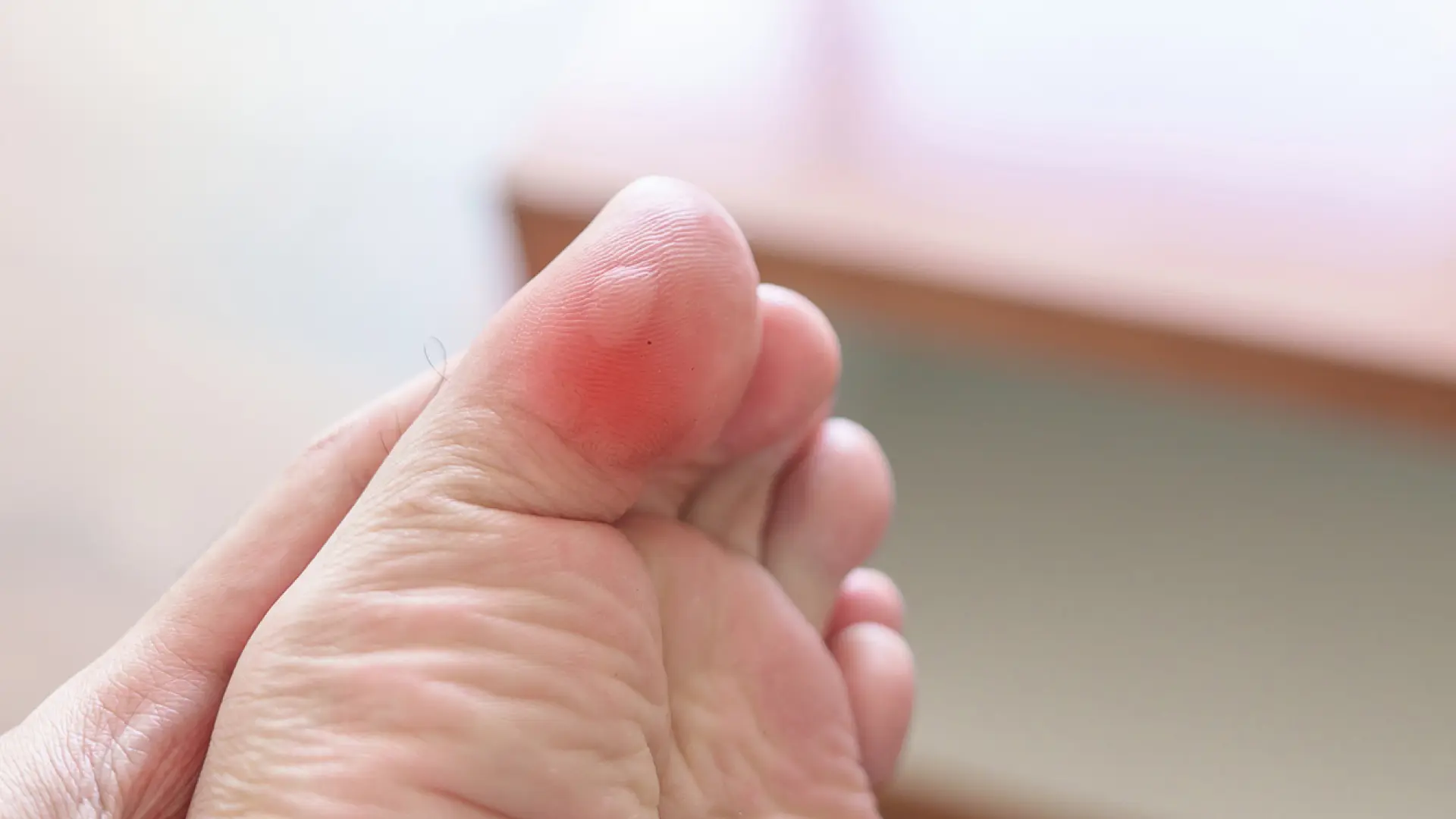 Ampollas: qué son, por qué surgen, qué hay dentro y cómo se curan