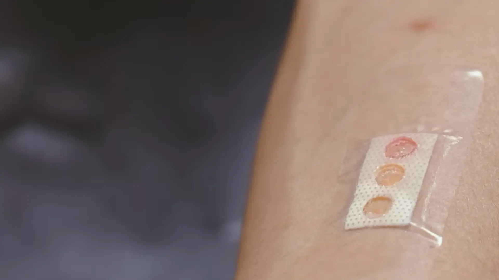 Así es la tirita inteligente que usa láser para el control de la ...