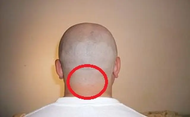 Media docena de curiosos términos de partes de nuestra anatomía (I)