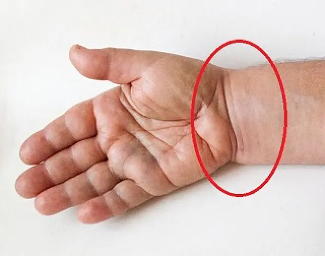 Media docena de curiosos términos de partes de nuestra anatomía (II)