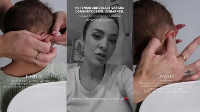 Aluvión de críticas a la 'influencer' Ruth Basauri por pegar las orejas de su hijo para ...