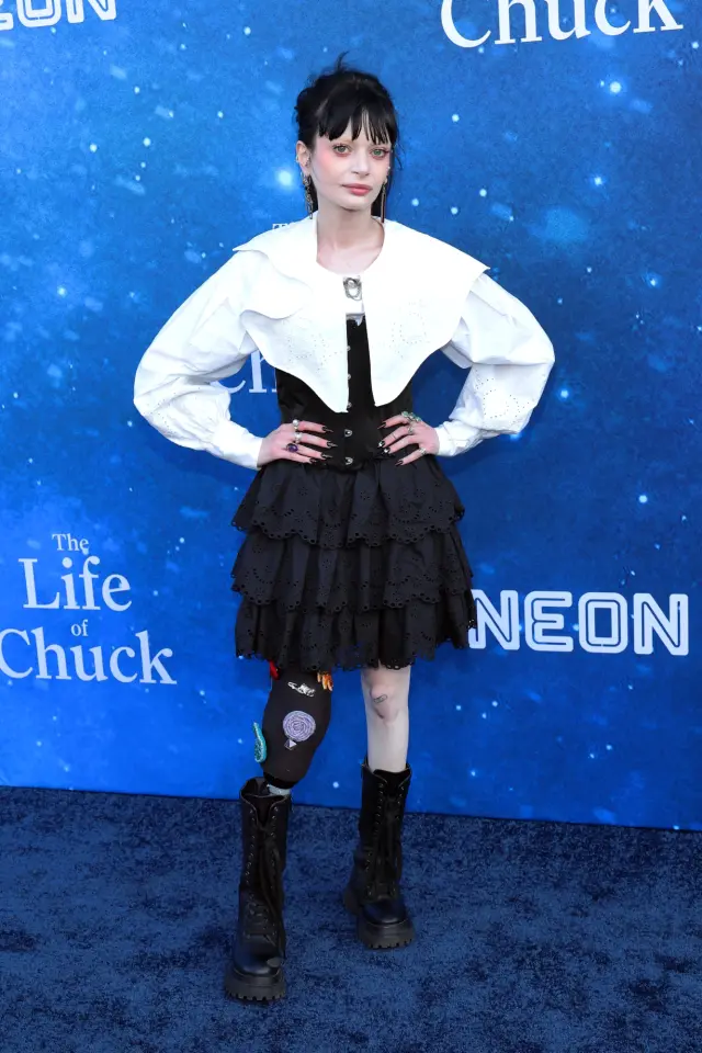 La actriz Ruth Codd sufre la amputación de la pierna que le quedaba ...