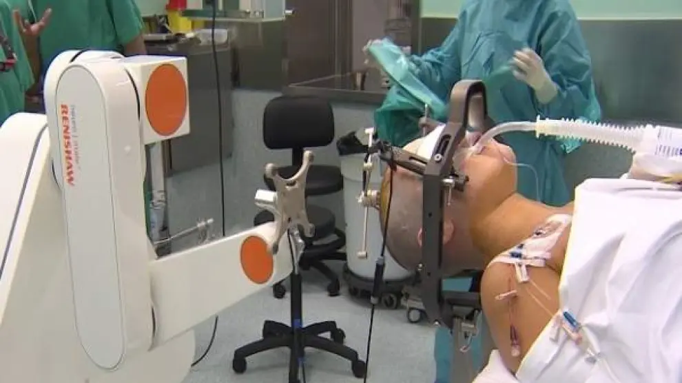Operan por primera vez en España con un robot a una enferma de párkinson