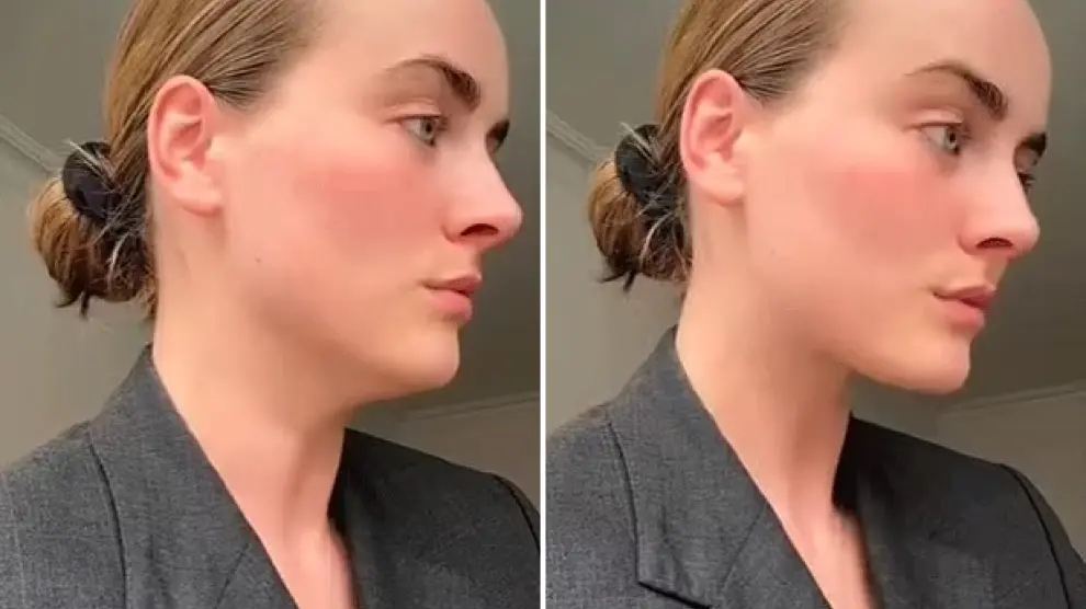 Qué es el 'mewing': el sencillo truco de famosas como Bella Hadid para ...