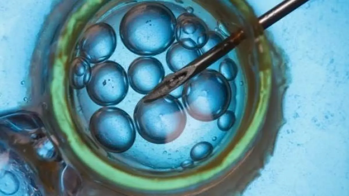 Confirman la indemnización a una mujer inseminada en una clínica con ...