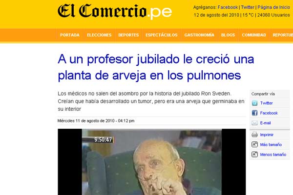 Creían que tenía un tumor, pero era una planta de guisante creciendo en ...