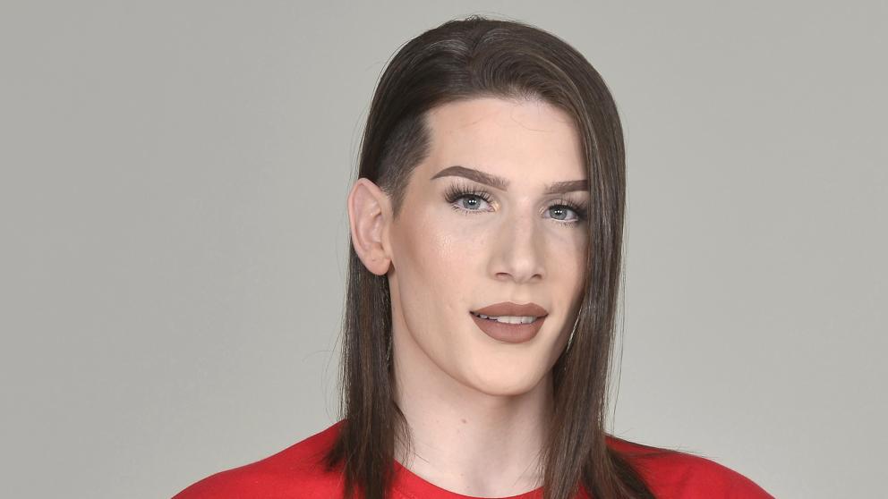 Oto Vans ('Supervivientes'), irreconocible tras su cirugía de ...