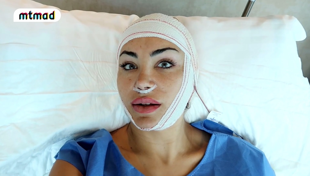 Daniela Requena se lima los huesos del cráneo tras cambiar el color de ...