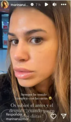 Marina Ruiz muestra su nuevo retoque estético: "Solo llevo un día, pero ...