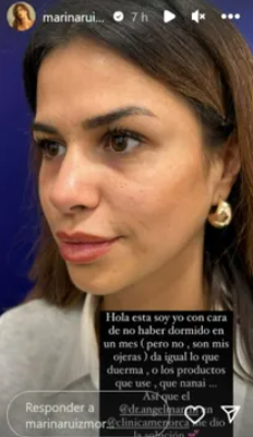 Marina Ruiz muestra su nuevo retoque estético: "Solo llevo un día, pero ...