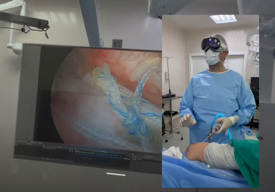 Un médico de Brasil usa las Apple Vision Pro durante una cirugía y ...