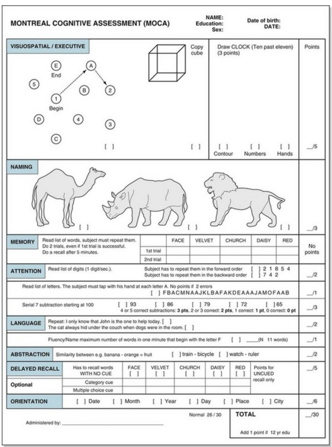 Así funciona el 'test MoCA' que examina las capacidades del presidente ...