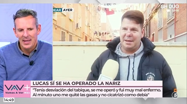 Nariz en silla de montar, así es la afección médica que padece Lucas de ...