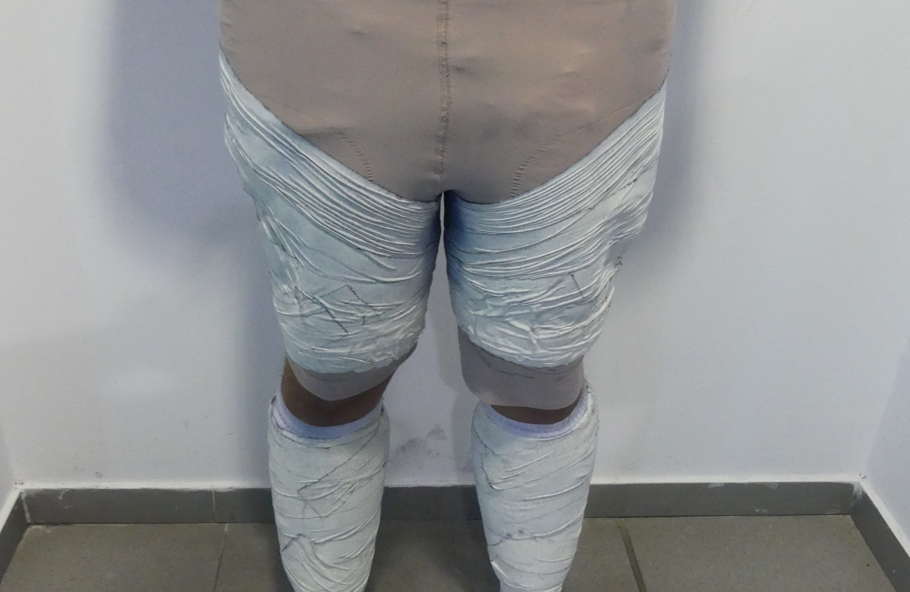 Detenida una "momia de la droga" en el aeropuerto de Barcelona: llevaba adosados al cuerpo con ...