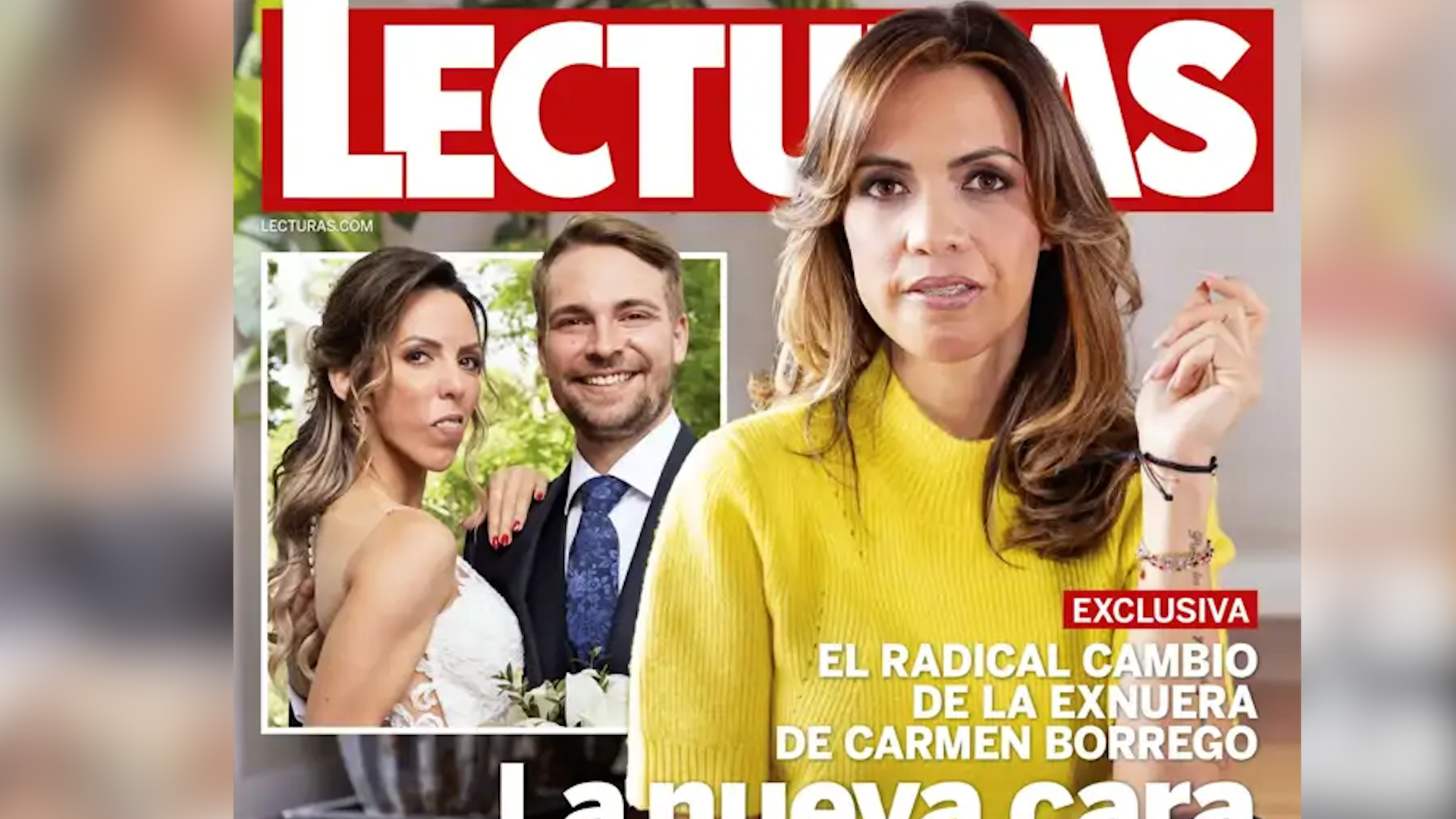 La nueva cara de Paola Olmedo, analizada por una doctora especializada: "Podría haber sufrido ...